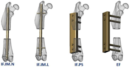 Surgical Classification for Preclinical Rat Femoral Bone Defect Model ...