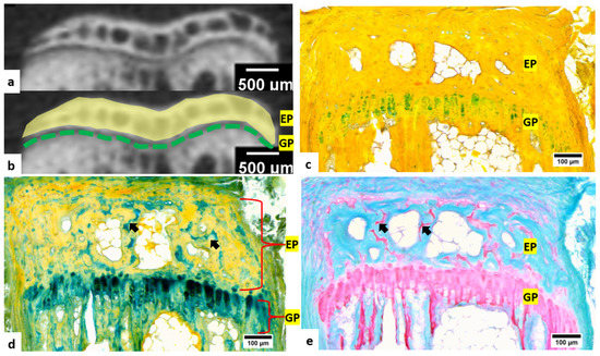 Multicolor Histochemical Staining for Identification of Mineralized and ...