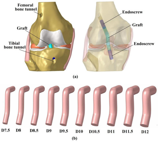 Bioengineering | Free Full-Text | Graft Diameter Should Reflect the ...