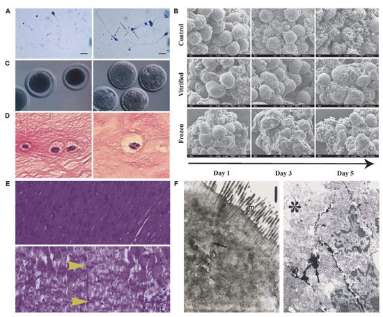 Biomolecular Pathways of Cryoinjuries in Low-Temperature Storage for ...
