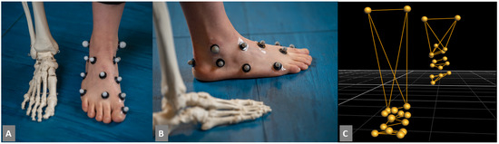 Bioengineering | Free Full-Text | Classification of Autism and Control ...