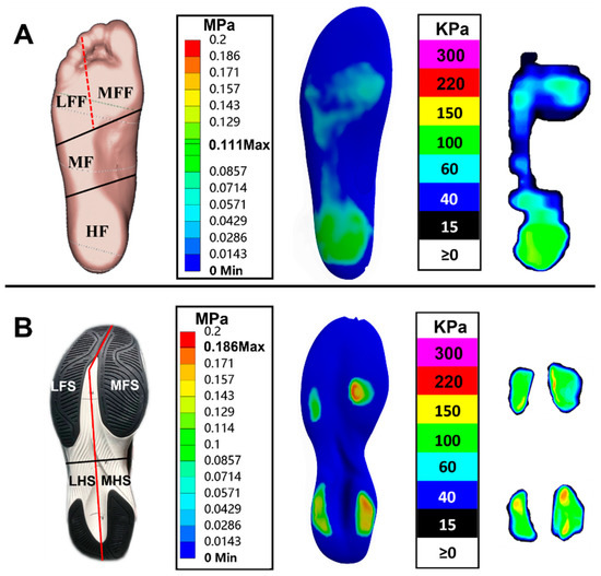 Development and Validation of a Subject-Specific Coupled Model for Foot ...
