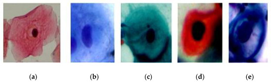 Cervical Net: A Novel Cervical Cancer Classification Using Feature Fusion