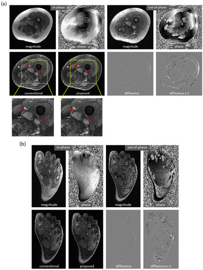 Deep Learning-Based Water-Fat Separation from Dual-Echo Chemical Shift ...