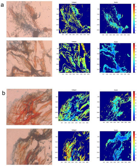 Stem Cell-Secreted Allogeneic Elastin-Rich Matrix with Subsequent ...