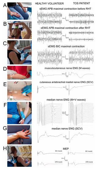 Relationships between the Clinical Test Results and Neurophysiological ...