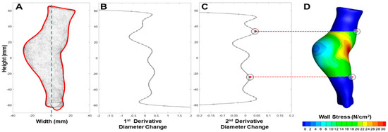 An Objective and Repeatable Sac Isolation Technique for Comparing Biomechanical Metrics in ...