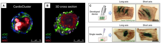 Engineered Tissue for Cardiac Regeneration: Current Status and Future ...