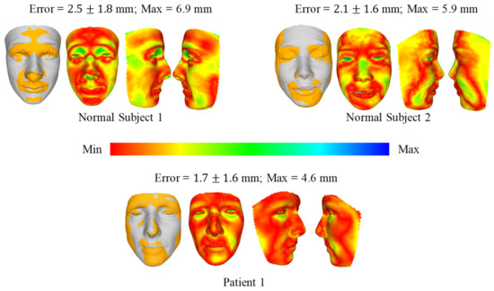 Fast 3D Face Reconstruction from a Single Image Using Different Deep ...