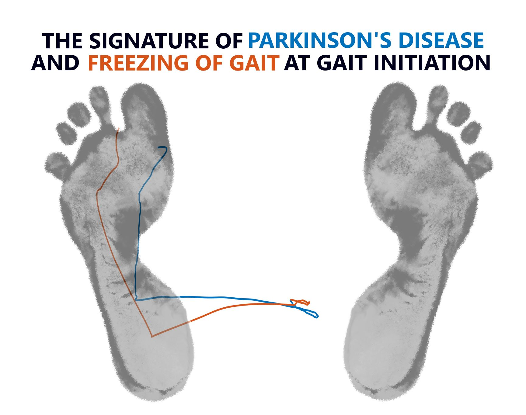 Bioengineering | Free Full-Text | Gait Initiation Impairment in ...