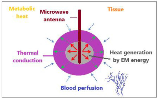 Computational Modeling of Microwave Tumor Ablation