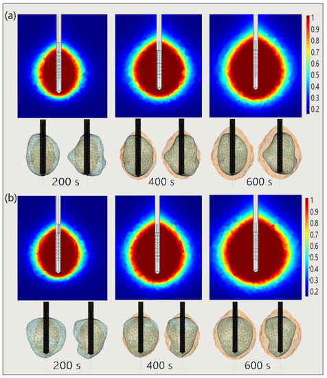 Computational Modeling of Microwave Tumor Ablation