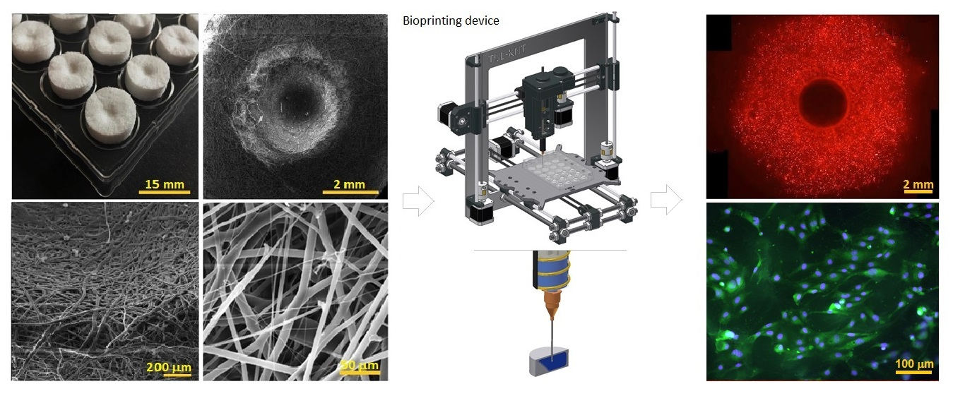 Bioengineering | Free Full-Text | The Combination of Hydrogels with 3D ...
