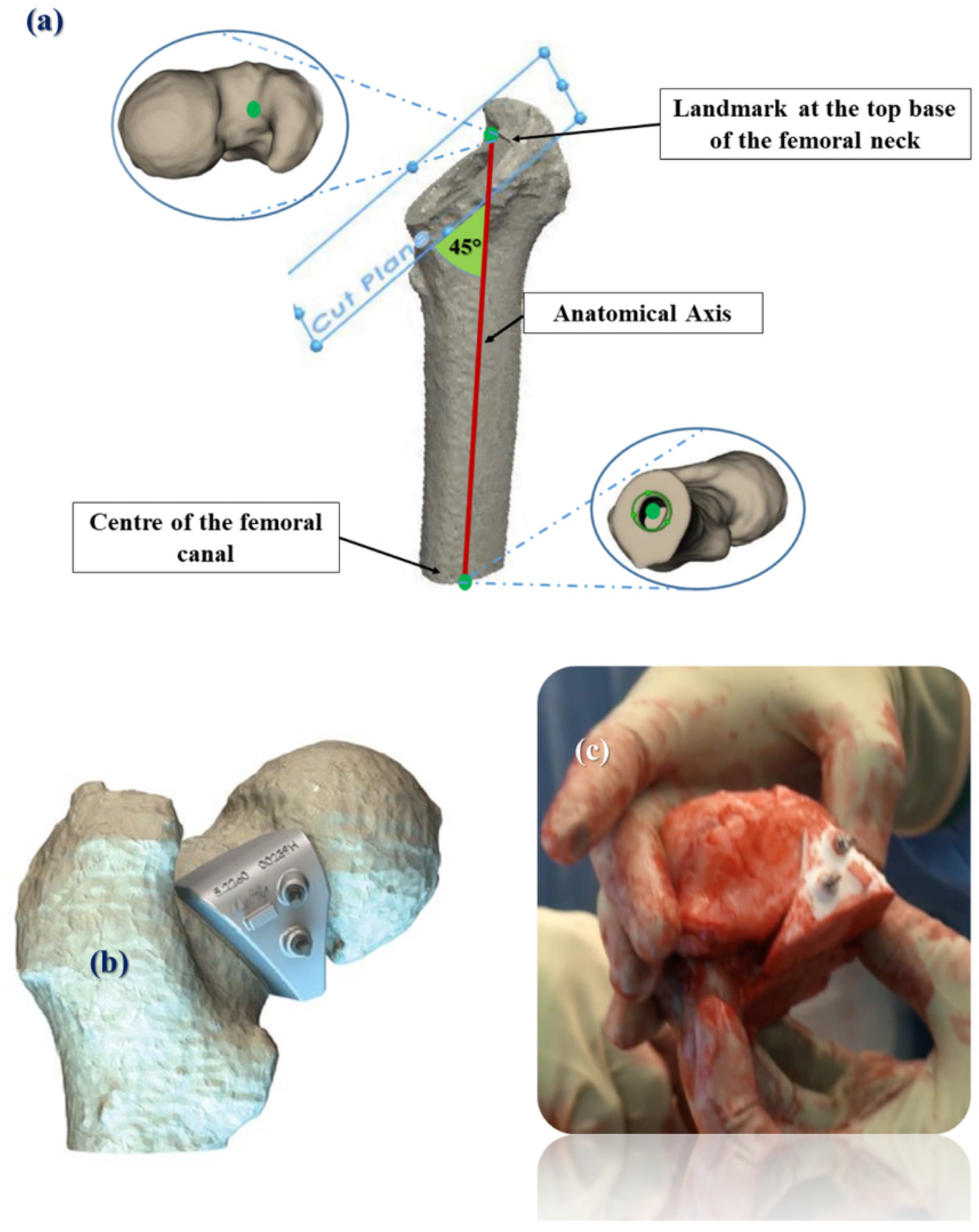 Bioengineering Free Full Text Accuracy Of A Three Dimensional 3d