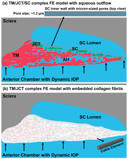 The Effect of Intraocular Pressure Load Boundary on the Biomechanics of ...