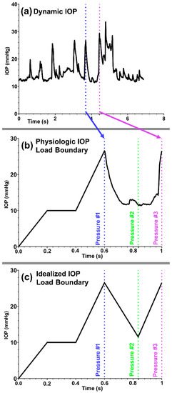The Effect of Intraocular Pressure Load Boundary on the Biomechanics of ...