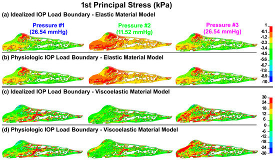The Effect of Intraocular Pressure Load Boundary on the Biomechanics of ...