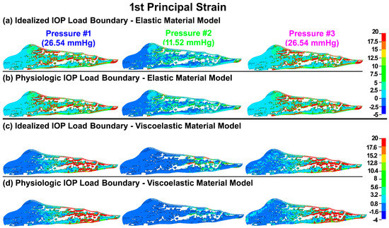 The Effect of Intraocular Pressure Load Boundary on the Biomechanics of ...