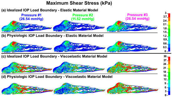 The Effect of Intraocular Pressure Load Boundary on the Biomechanics of ...