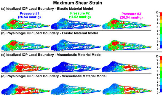 The Effect of Intraocular Pressure Load Boundary on the Biomechanics of ...
