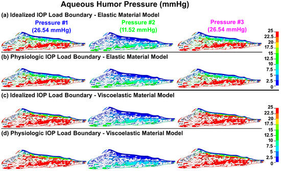 The Effect of Intraocular Pressure Load Boundary on the Biomechanics of ...