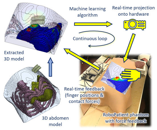 Bioengineering | Free Full-Text | A Surrogate Model Based on a Finite ...