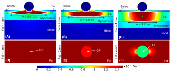 Pulsed Electric Field Ablation of Epicardial Autonomic Ganglia ...