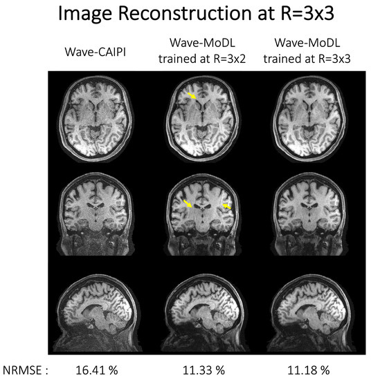 Wave-Encoded Model-Based Deep Learning for Highly Accelerated Imaging with Joint Reconstruction
