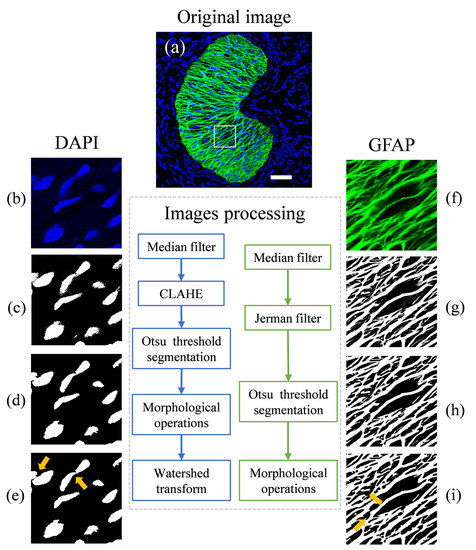 Morphological Changes of Glial Lamina Cribrosa of Rats Suffering from ...