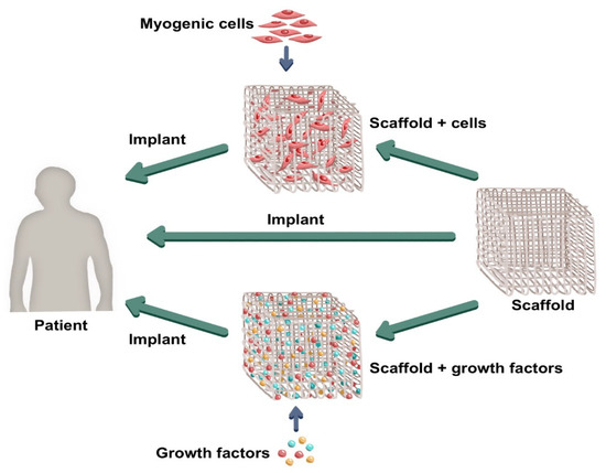 Tissue Engineering Applied to Skeletal Muscle: Strategies and Perspectives