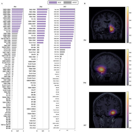 Automatic Localization of Seizure Onset Zone Based on Multi ...