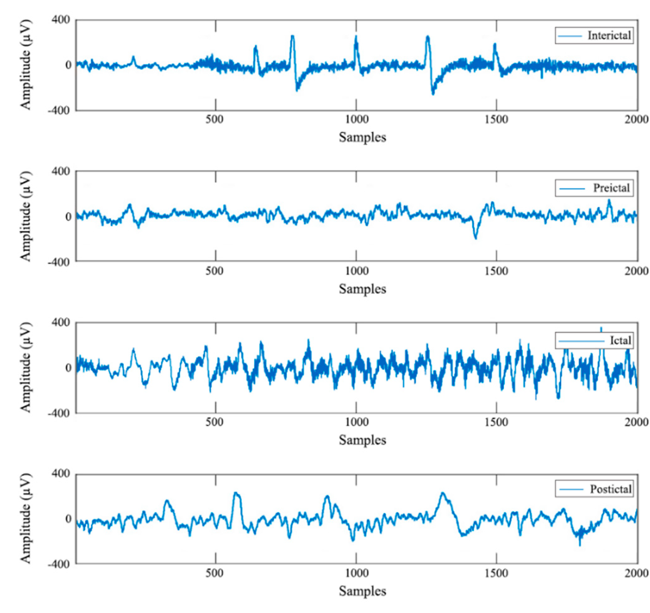 Supervised Machine Learning and Deep Learning Techniques for Epileptic Seizure Recognition Using ...