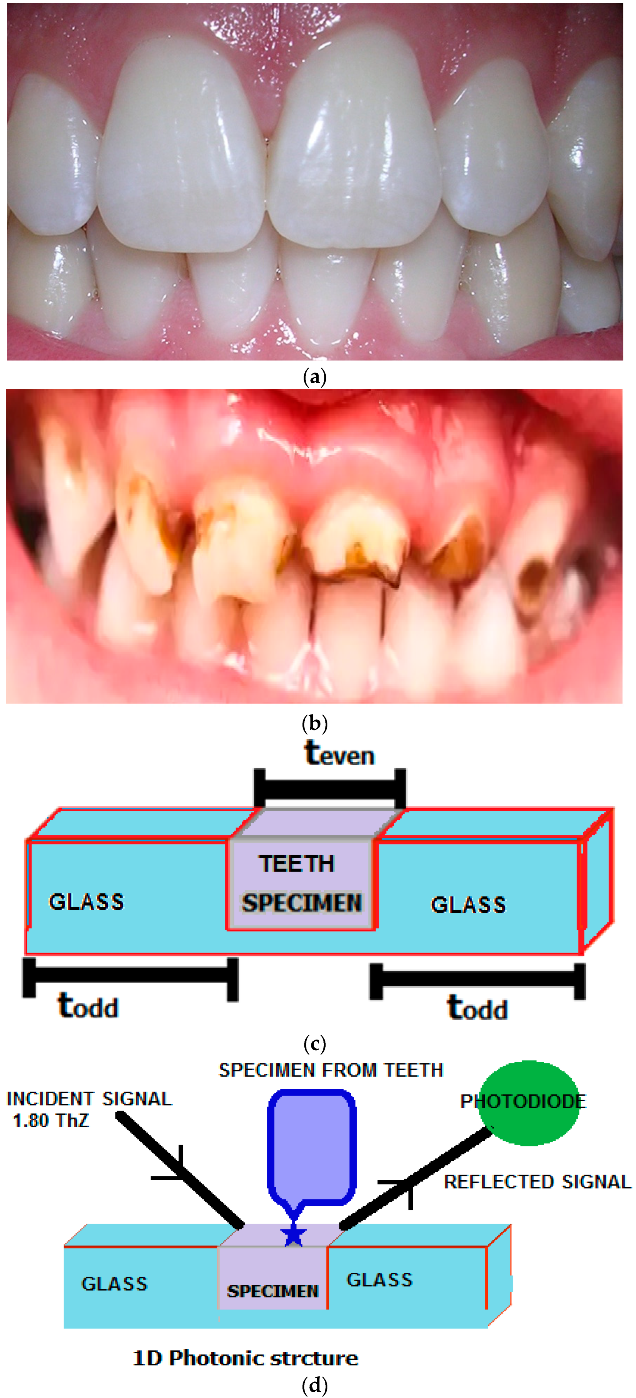 Bioengineering | Free Full-Text | Investigation on Enamel and Dentine ... Bioengineering | Free Full-Text | Investigation on Enamel and Dentine ...