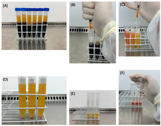 Platelet-Rich Plasma Gel Matrix (PRP-GM): Description of a New Technique