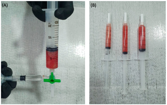 Platelet-Rich Plasma Gel Matrix (PRP-GM): Description of a New Technique