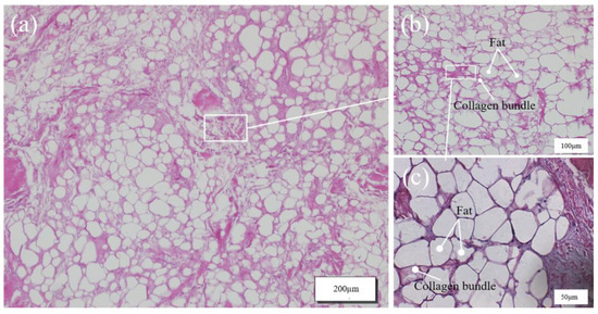 The Bionic High-Cushioning Midsole of Shoes Inspired by Functional ...