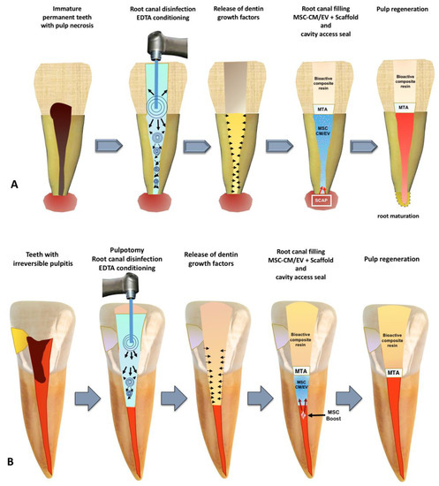 Bioengineering | Free Full-Text | Towards a New Concept of Regenerative ...