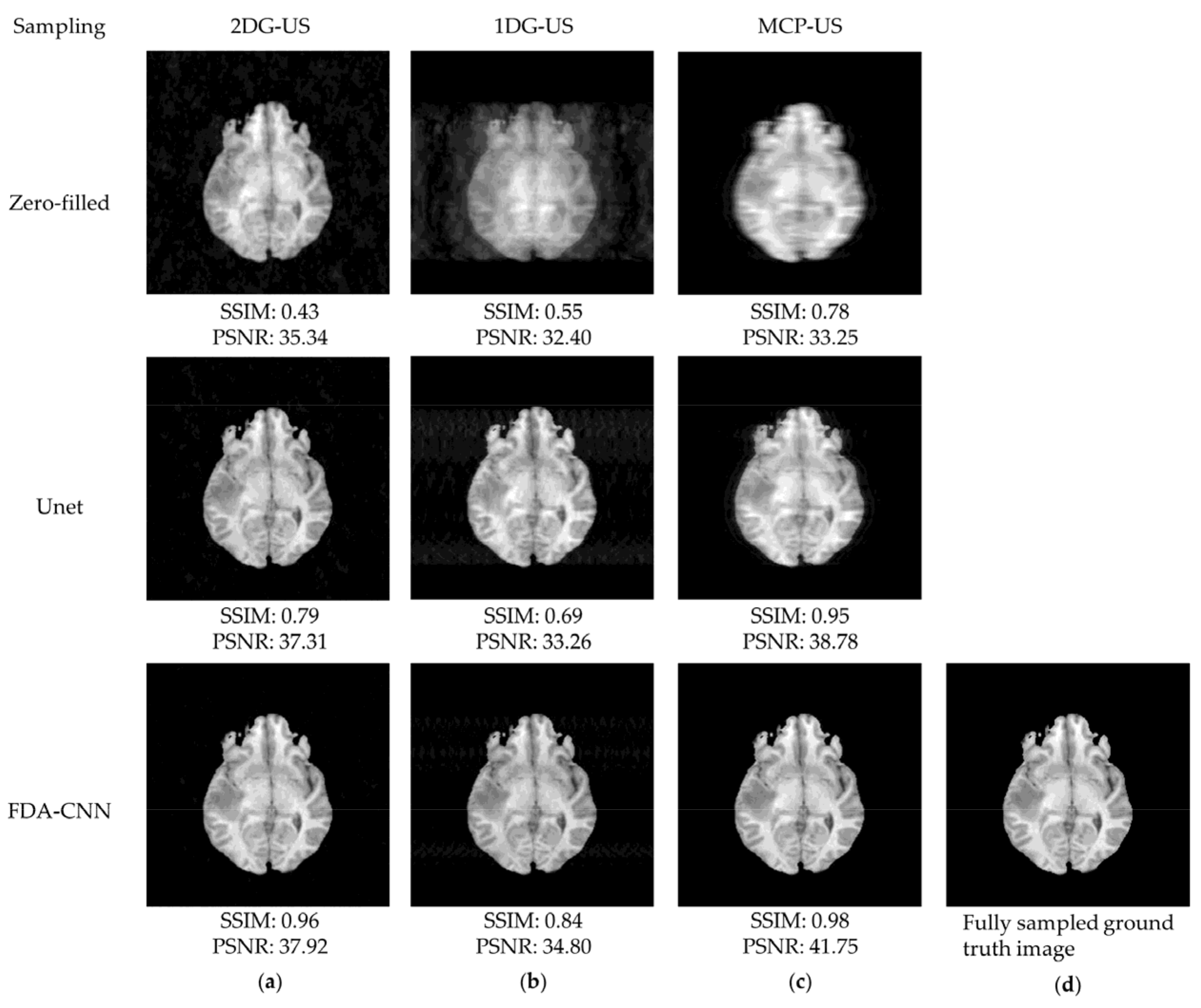 De-Aliasing and Accelerated Sparse Magnetic Resonance Image ...