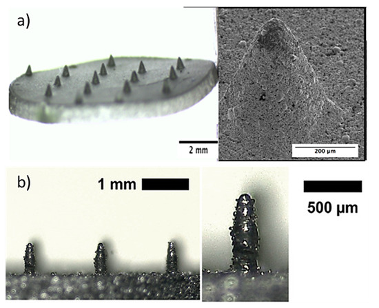 Metallic Microneedles for Transdermal Drug Delivery: Applications ...