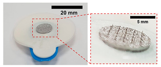 Metallic Microneedles for Transdermal Drug Delivery: Applications ...