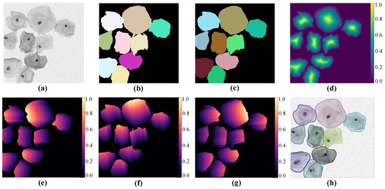 Bioengineering | Free Full-Text | Automatic Segmentation of Cervical ...