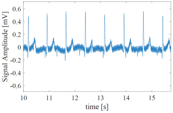 Fetal Arrhythmia Detection Based on Labeling Considering Heartbeat Interval