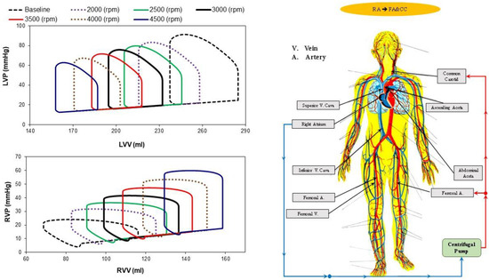 Evaluation of Different Cannulation Strategies for Aortic Arch Surgery ...