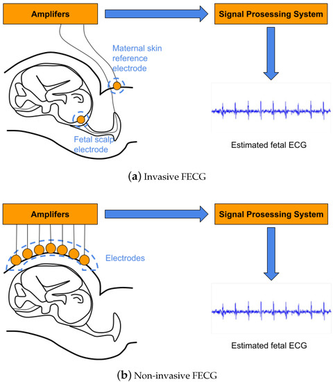 Unsupervised Learning-Based Non-Invasive Fetal ECG Muti-Level Signal Quality Assessment