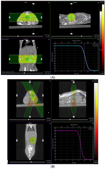 Radiotherapy Advances in Renal Disease—Focus on Renal Ischemic ...