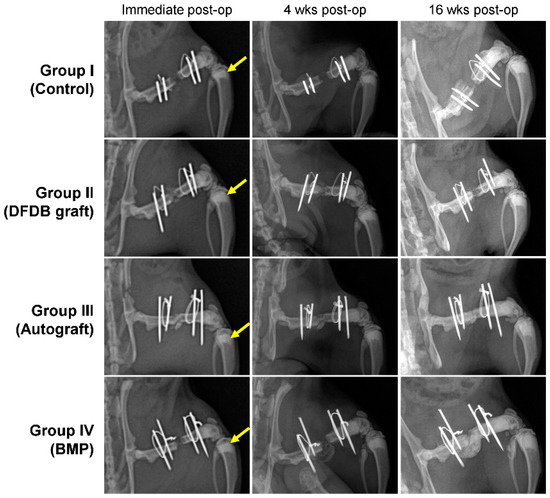 Bone Morphogenetic Protein 2 Promotes Bone Formation in Bone Defects in ...