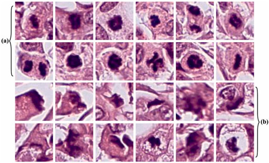 Artificial Hummingbird Algorithm with Transfer-Learning-Based Mitotic ...