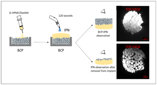 Injectable Hydrogel Membrane for Guided Bone Regeneration