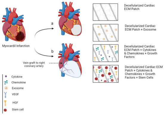 Whole-Heart Tissue Engineering and Cardiac Patches: Challenges and Promises