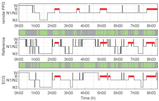 Contactless Camera-Based Sleep Staging: The HealthBed Study